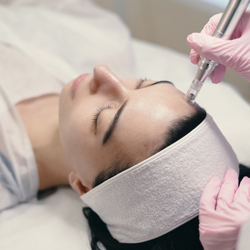 Micro-needling - PHP Training Academy